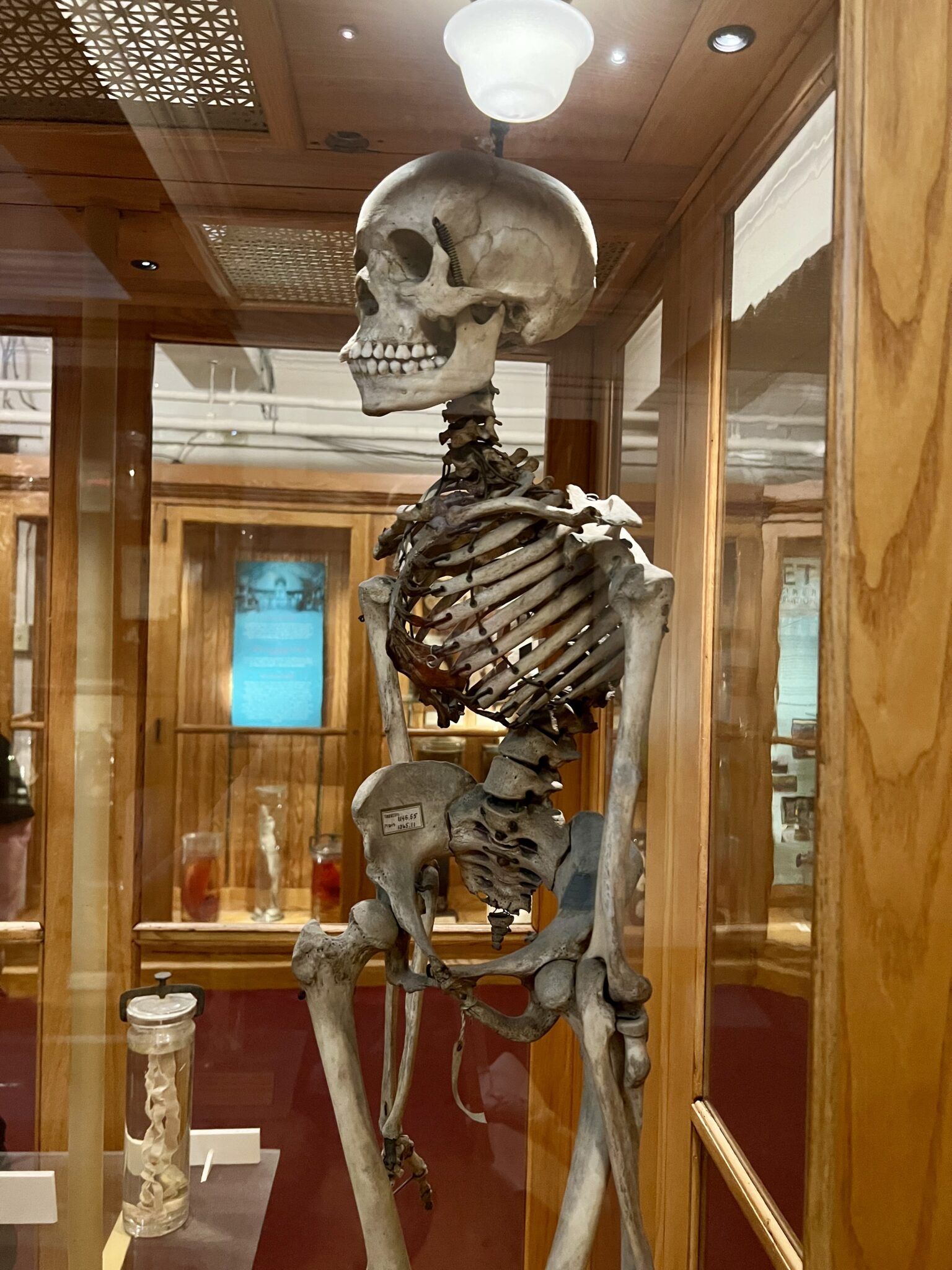Guide To The Mutter Museum, Philadelphia's Medical History Museum - The ...